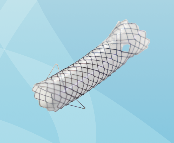 SOO Stent – Meditek Systems